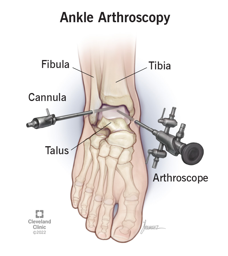 South Florida Foot And Ankle Sports Institute south-florida-foot-and-ankle-sports-institute