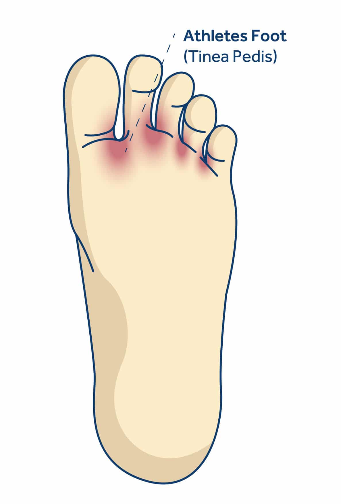 Foot Ankle and Leg Specialists of South Florida