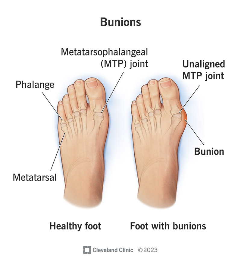 Foot Ankle and Leg Specialists of South Florida