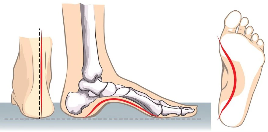 Foot Ankle and Leg Specialists of South Florida